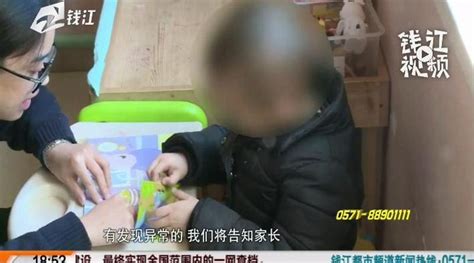 关爱自闭症儿童 学会正确的相处方式 社会 民生 好看视频