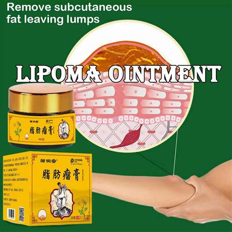 Lipoma Cream 20 Gamot Sa Bukol Bukol Cream Lipoma Removal Cream Original Japan Bukol Cream