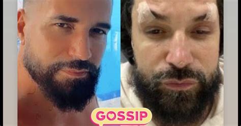 O Antes E Depois De Latino Chocou A Web Purepeople