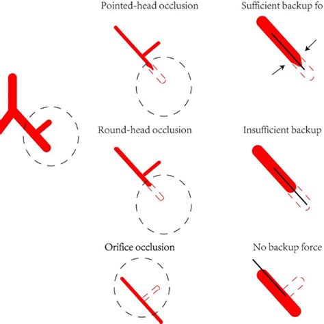 Model Figure Of Three Types Of Occlusions The Figure Demonstrated The