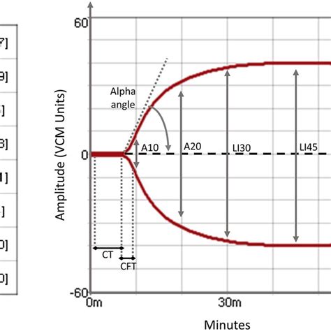 A Typical Vcm Trace That Shows Vcm Measurement Parameters Ct Clotting