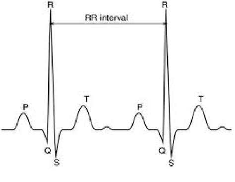 An Ideal Ecg Signal R R Interval With Various Waves Download Scientific Diagram