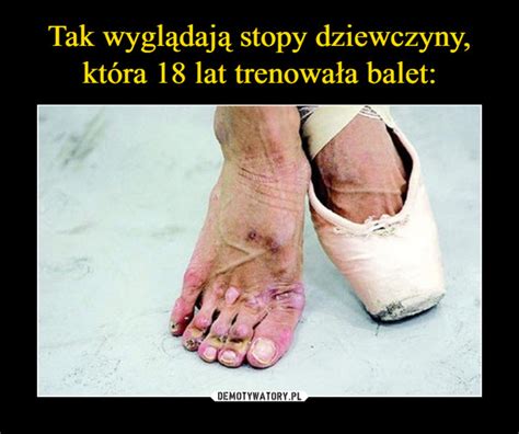 Tak wyglądają stopy dziewczyny, która 18 lat trenowała balet ...
