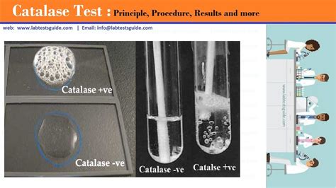 Catalase Test