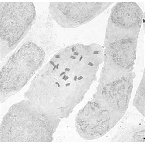 Root Tip Squash Showing N Chromosomes For An Individual Of Download Scientific Diagram