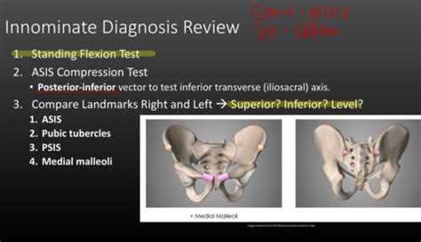 Lab Pelvis Flashcards Quizlet