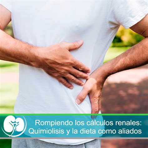 Cálculos Renales No Más Sigue Estos Consejos Uroinfo