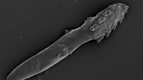 Scientists Say Face Mites Evolved Alongside Humans Since The Dawn Of