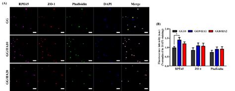 Rpe Specific Protein Expression Analyzed By A Immunofluorescence