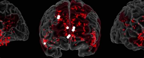 Scientists Identify Neural Network Vital For Creativity In The Brain