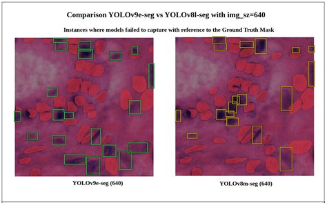 Yolov Instance Segmentation On Medical Dataset