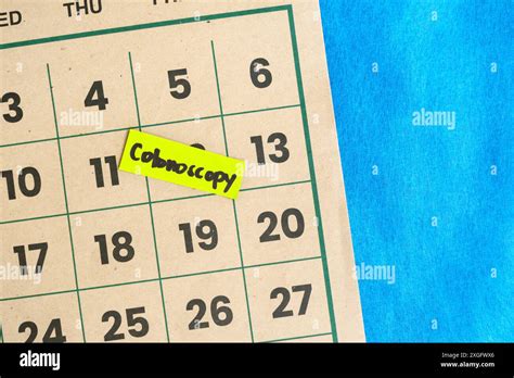 Colonoscopy Medical Procedure Schedule Concept Written Reminder Note