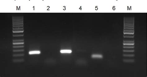 Figure 1 From Detection Of Sars Cov 2 Using Reverse Transcription