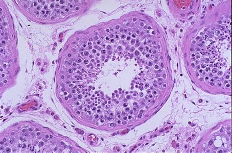 Seminiferous Tubules Histology Labeled