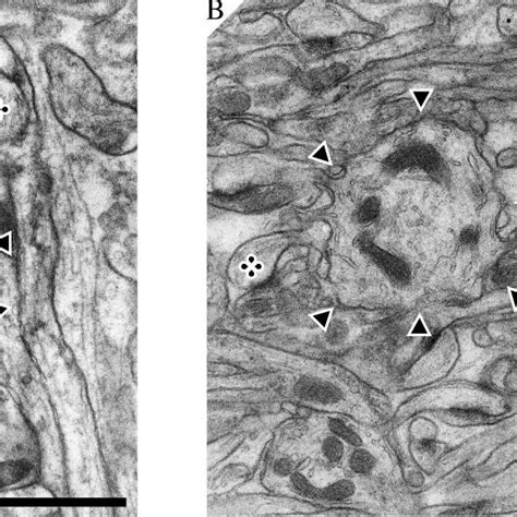 Direct Comparison Of Two Electron Photomicrographs Of Synapses Made By