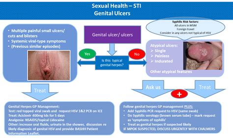 Genital Ulcers Herpes Simplex Refhelp