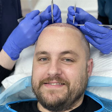 Alex Dodman British Hair Clinic