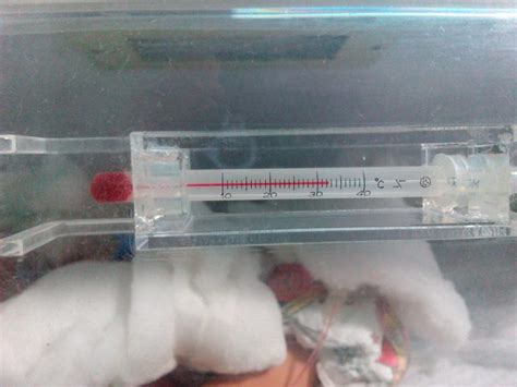 How To Measure Body Temperature Surgicaltechie