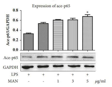 Acetyl NF kappaB p65 Lys310 Antibody Affinity Biosciences LTD 亲科生物官网