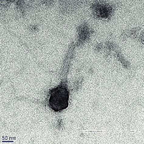Transmission Electron Microscopy Of The Phage Download Scientific Diagram