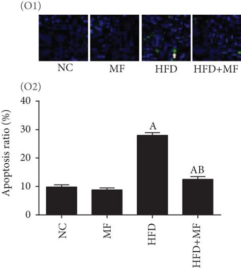 Protective Effects Of Metformin On High Fat Diet Induced Inflammatory