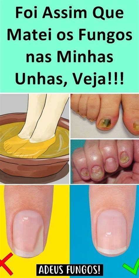 Pin Em Veja Todos Os Meus Pins