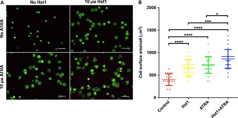 Alltrans Retinoic Acid And Human Salivary Histatin1 Promote The