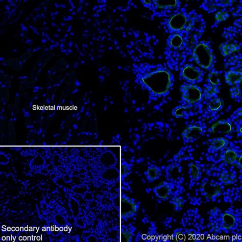 Recombinant Anti Thyroid Peroxidasetpo Antibody Epr23574 405 Ab278525