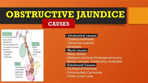Obstructive Jaundice Problem Oriented Approach Pptx