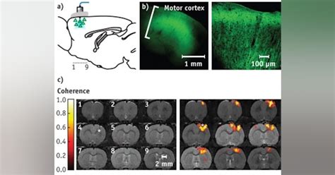 Neurologylight Tissue Interaction In Vivo Precision Targeting With