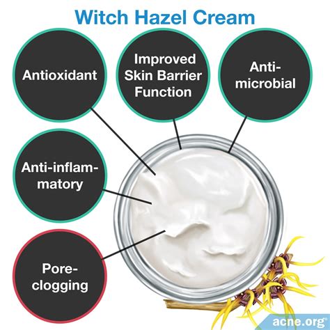 Can Witch Hazel Help Acne