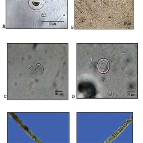 A Chroococcus Minor Kützing Nägeli 1849 B Chroococcus Turgidus