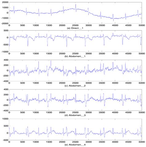 Sensors Free Full Text Single Lead Fetal Ecg Extraction Based On A Parallel Marginalized