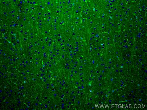 ager rage antibody 83759 4 rr proteintech