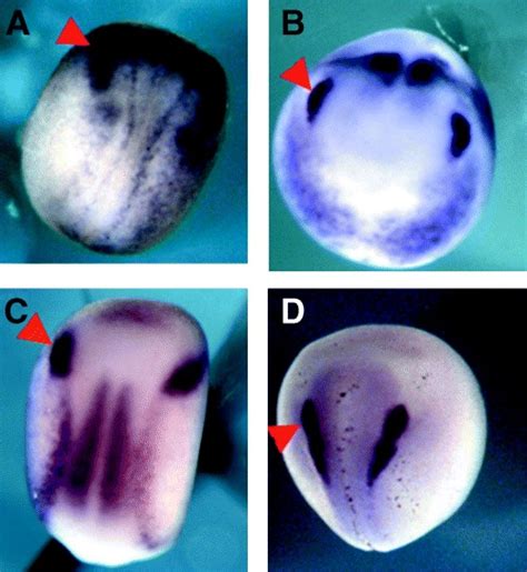 Neural Crest Patterns Four Induced Genes Showing Strong Expression In Download Scientific