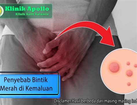 Memahami Warna Urine Yang Sehat Dan Abnormal Klinik Apollo Jakarta