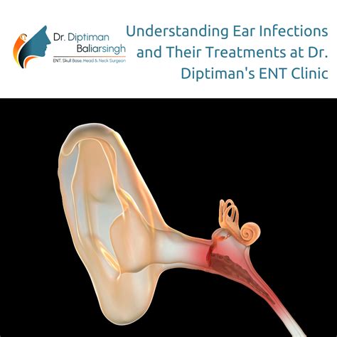 Understanding Ear Infections And Their Treatments At Dr Diptimans