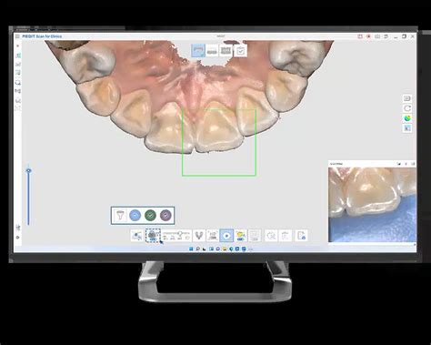 Medit Scan For Clinics Medit Intraoral Scanner And Dental Software