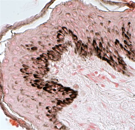 Vitroview™ Fontana Masson Stain Kit