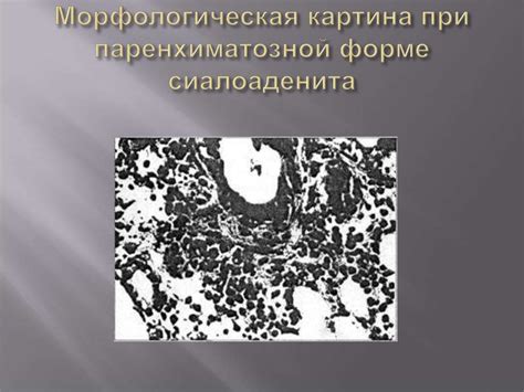 Хроническое воспаление слюнных желез презентация онлайн