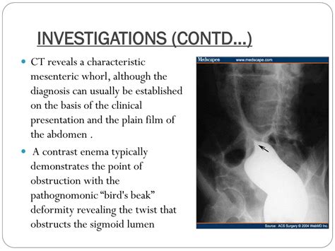 Ppt Sigmoid Volvulus Powerpoint Presentation Free Download Id 8792829
