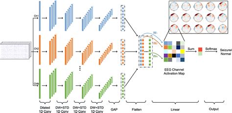 Figure 1 From Lightseizurenet A Lightweight Deep Learning Model For