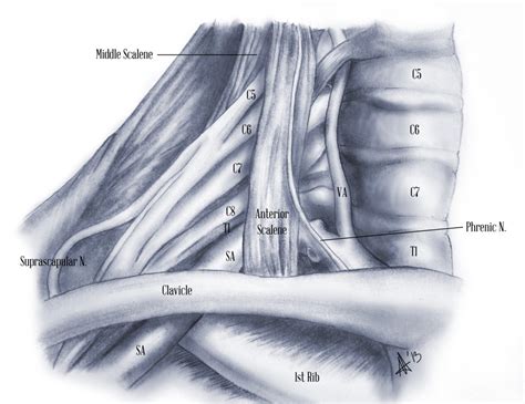 Interscalene Block Vertebral Artery At Hunter Wang Blog