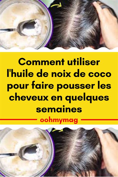 Comment Utiliser L Huile De Noix De Coco Pour Faire Pousser Les Cheveux