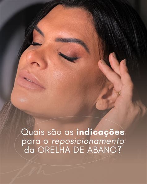 Portal Arcos Quais são as indicações para o reposicionamento da ORELHA DE ABANO