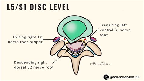 Lumbar Nerve Root Anatomy