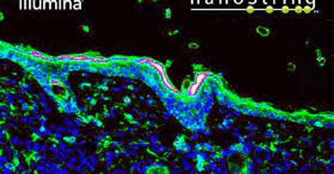 Illumina Spatial Proteogenomics Nanostring Geomx® Digital Spatial…