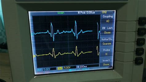 Measure Ment The Ecg Signal Using Oscilloscope And Sound Card Youtube