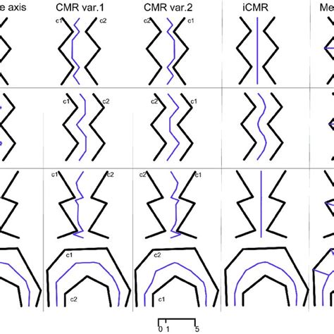 The Comparison Of Results Of Cmr Icmr Medial Axis Algorithms And