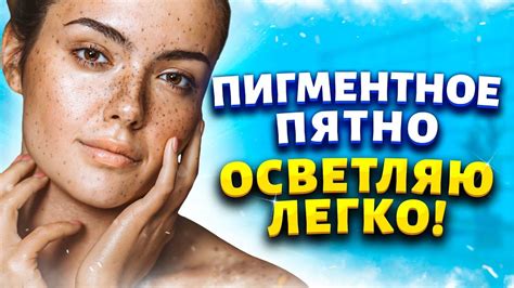 От пигментных пятен не осталось и следа Покажу две хитрости которые